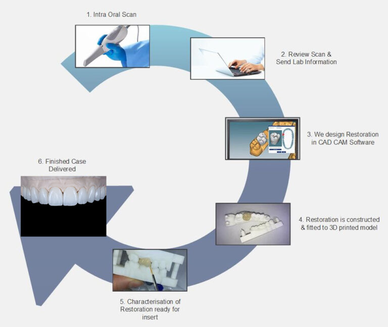 Digital Workflow - Dental Opsis Clinic